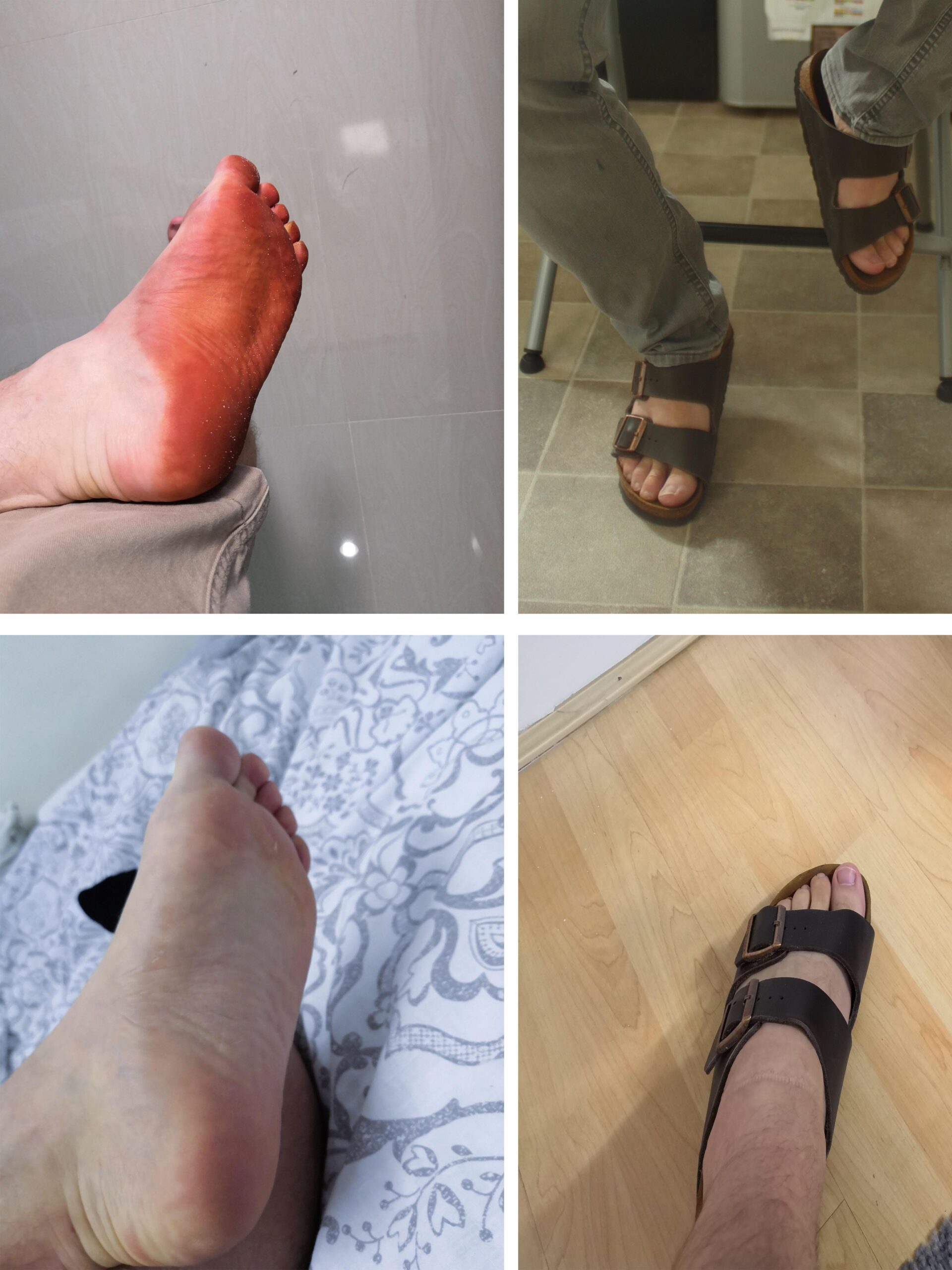 How To Stop Birkenstocks From Staining Feet?